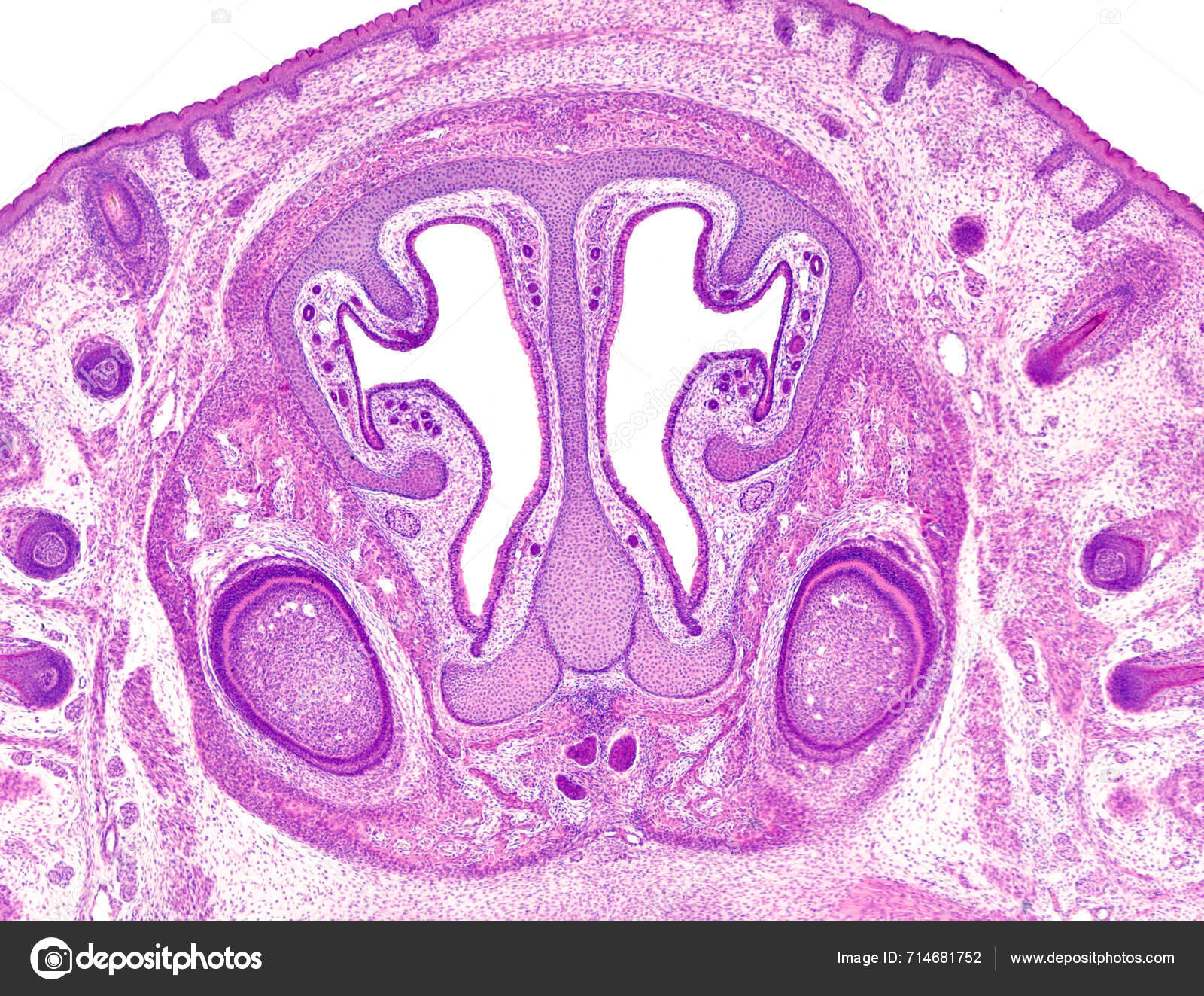 Frontal Section Rat Embryo Head Showing Nasal Cavities Turbinates Nasal ...