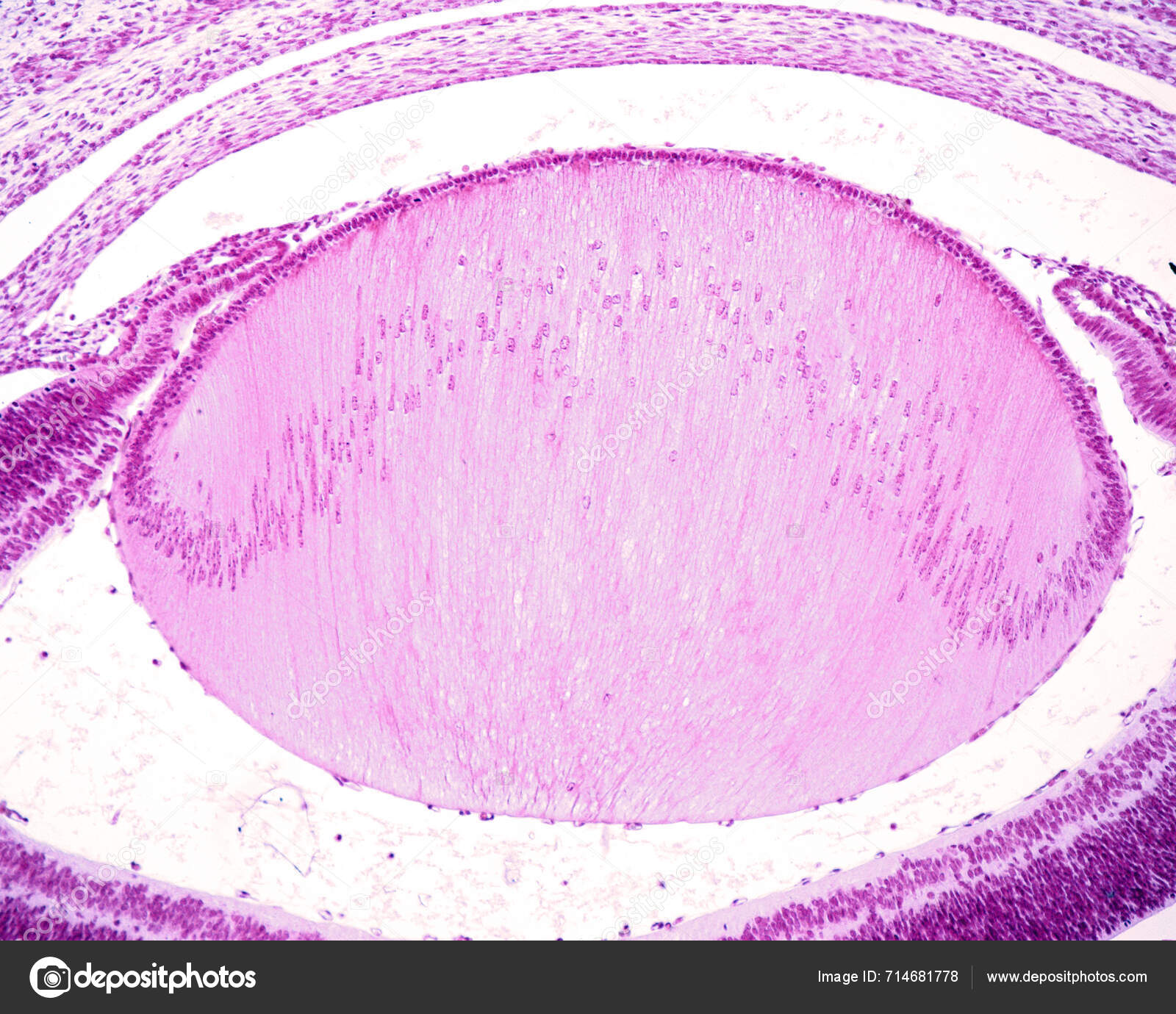 Eye Lens Light Micrograph Equator Lens Developing Eye Showing ...