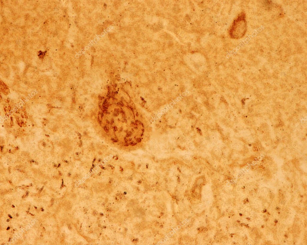 Corteza cerebelosa. Micrograf a de alto aumento de c lulas de Purkinje ...