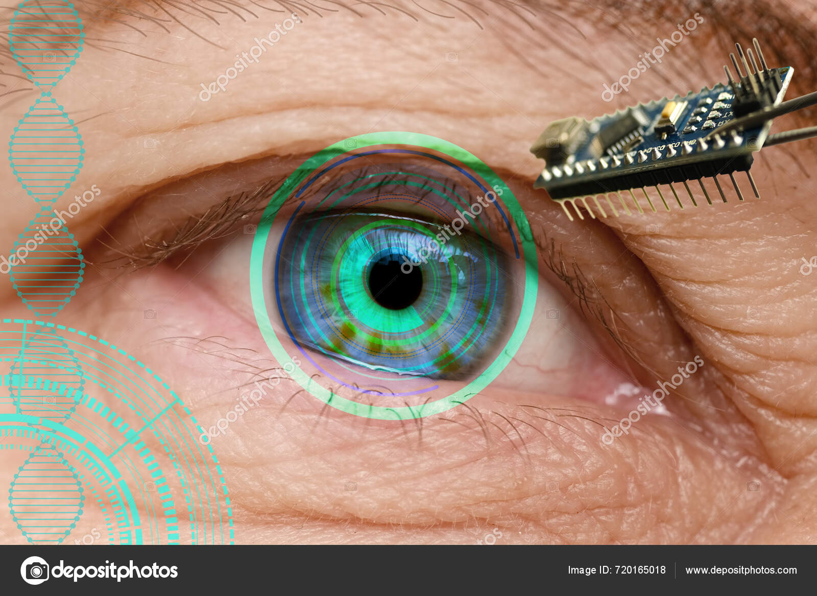 Installing Electronic Chip Human Bionic Neuroprosthetic Eye Cutting ...