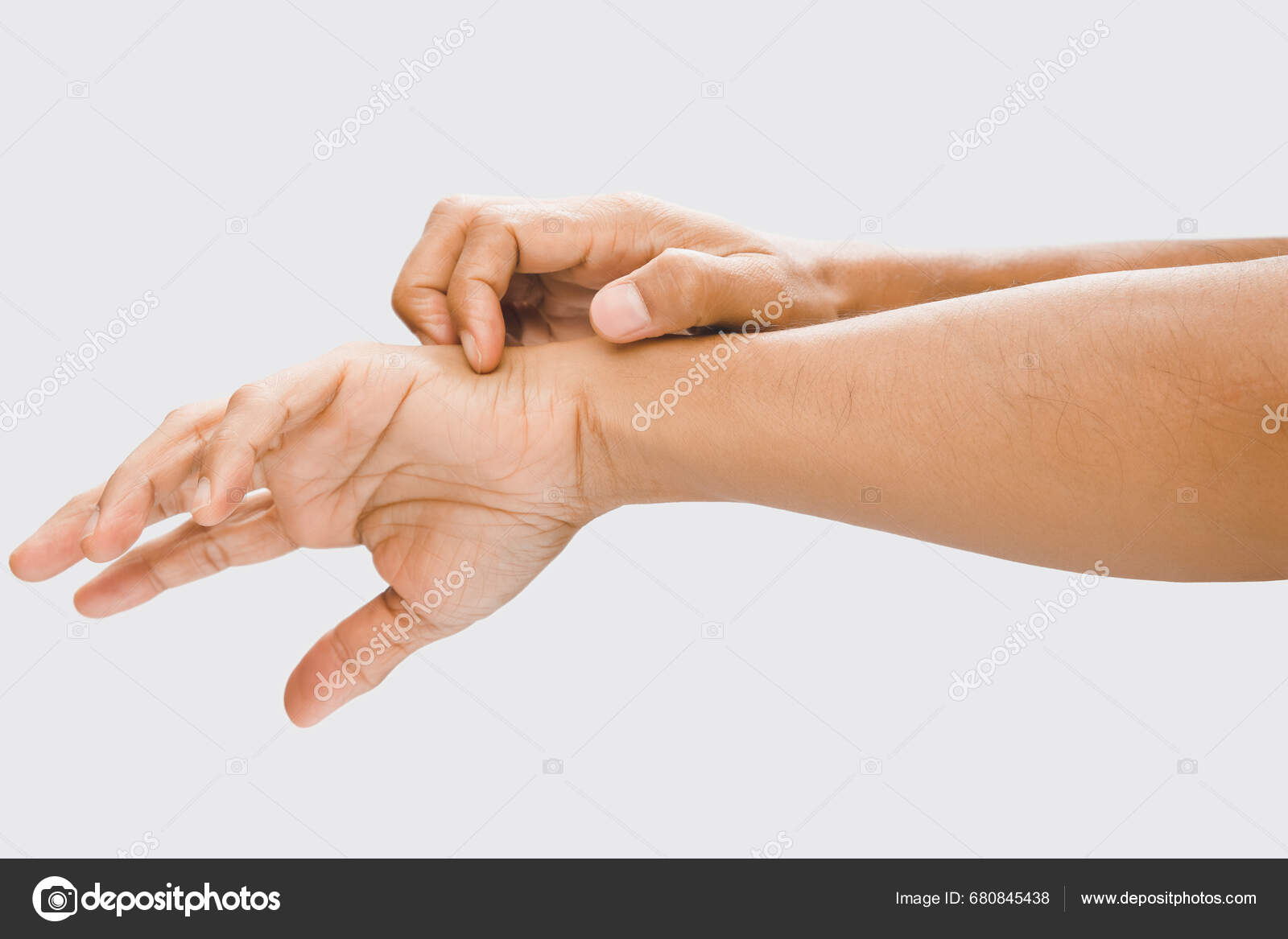 Man Scratching His Back Hand Because Has Itch Due Allergic Stock Photo ...