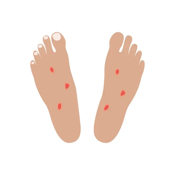 42,717,533 Neuropatia Vector Images | Depositphotos