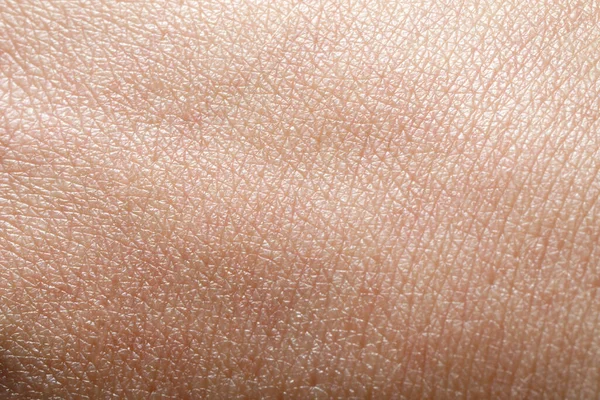 Collage Demonstrating Comparison Dry Moisturized Human Skin Closeup ...