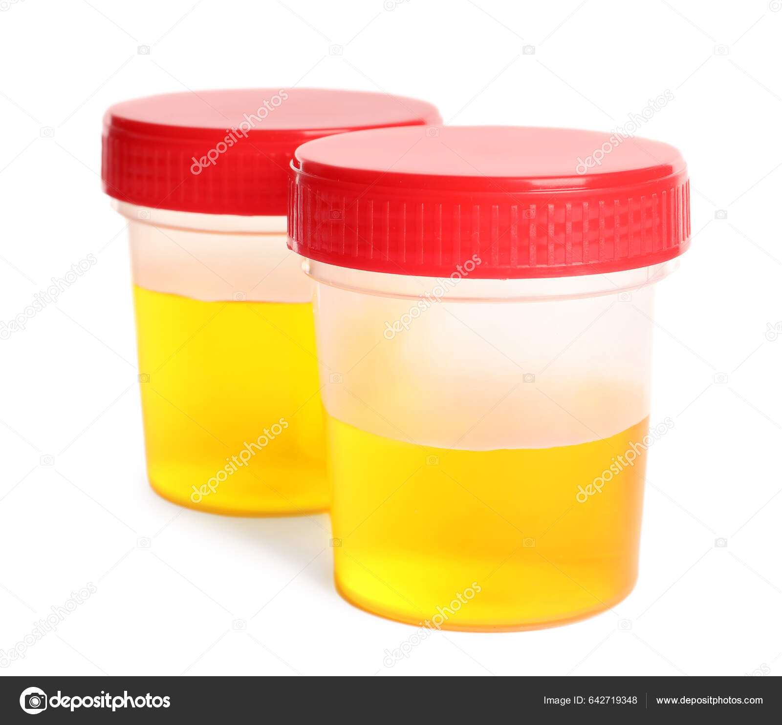Containers Urine Sample Analysis White Background — Stock Photo ...