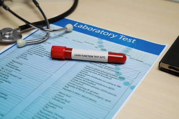 Prueba de función hepática. Tubo con muestra de sangre, estetoscopio y ...