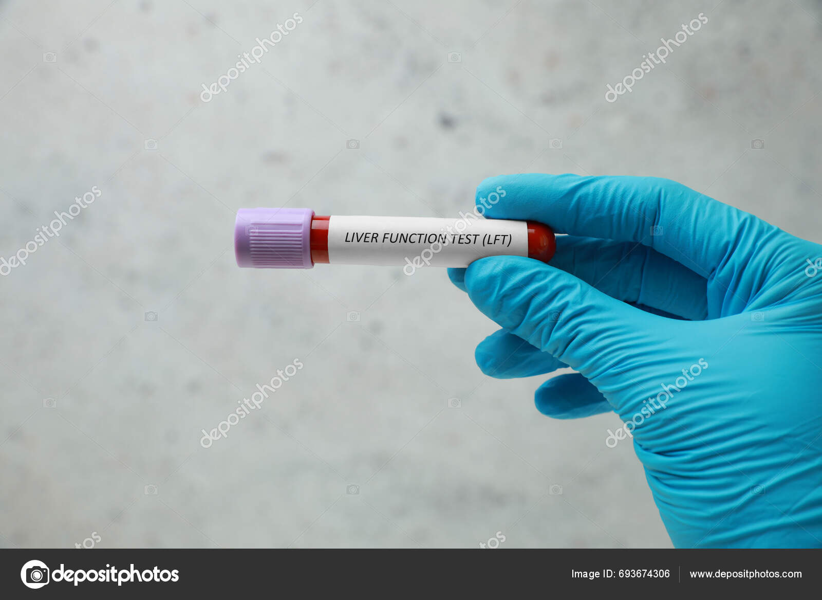 Laboratory Worker Holding Tube Blood Sample Label Liver Function Test ...
