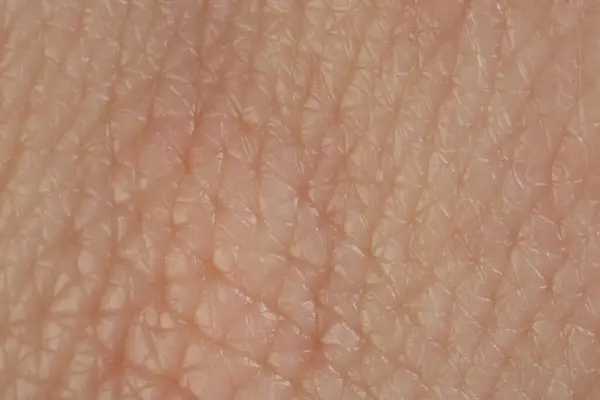 Gross skin conditions Stock Photos, Royalty Free Gross skin conditions ...