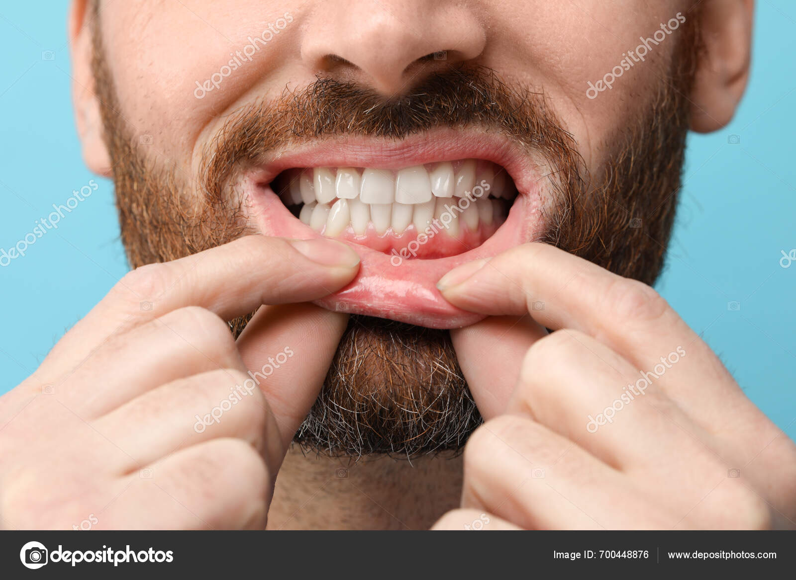 Man Showing His Healthy Teeth Gums Light Blue Background Closeup ...