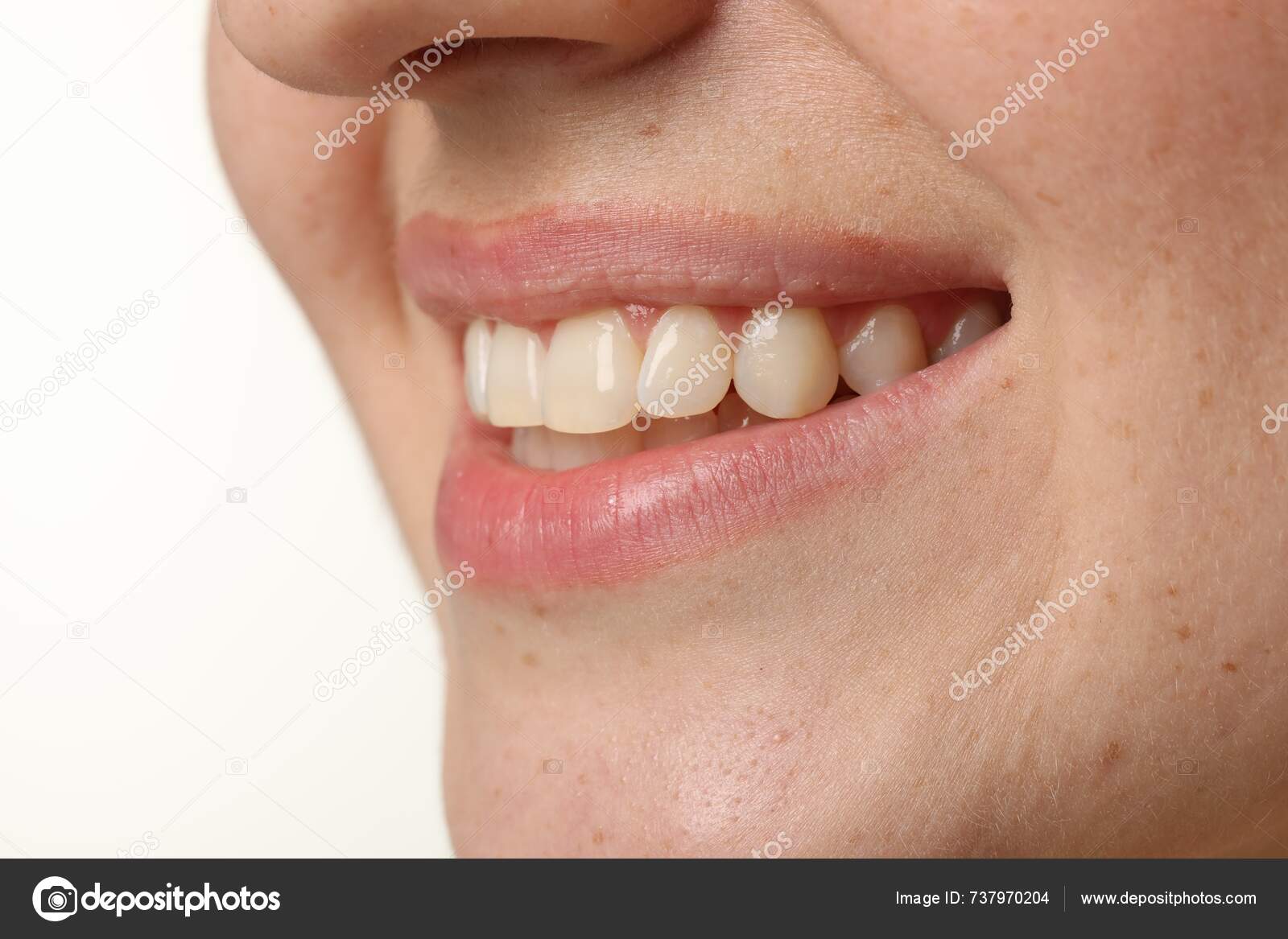 Smiling Woman Healthy Clean Teeth White Background Closeup — Stock ...