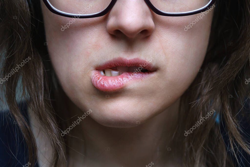 Cropped image of womans face biting skin on dry chapped lips 2024