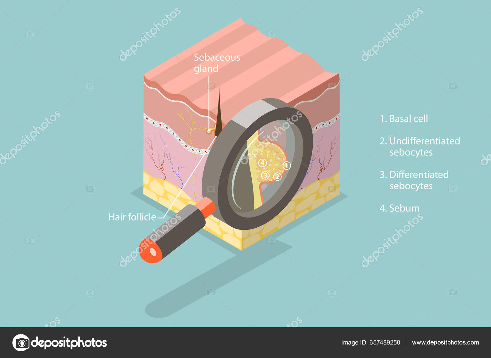 Ilustración Conceptual Del Vector Plano Isométrico Glándula Sebácea ...