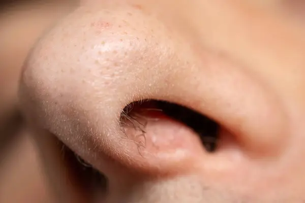 Open nose Stock Photos, Royalty Free Open nose Images | Depositphotos