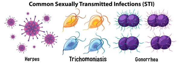 Infecciones de transmisión sexual (ITS) comunes ilustración 2024