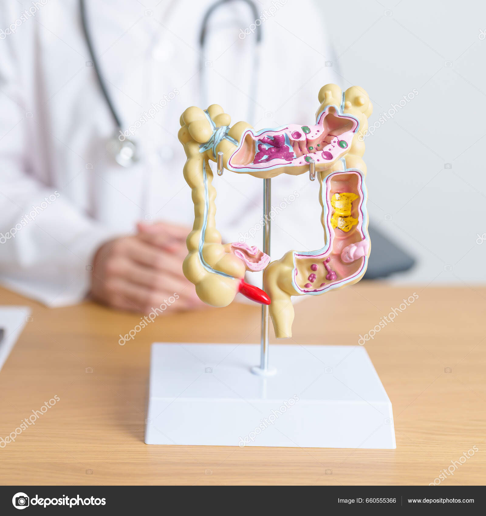 Doctor Con Modelo Anatomía Humana Colon Enfermedad Colon Intestino ...