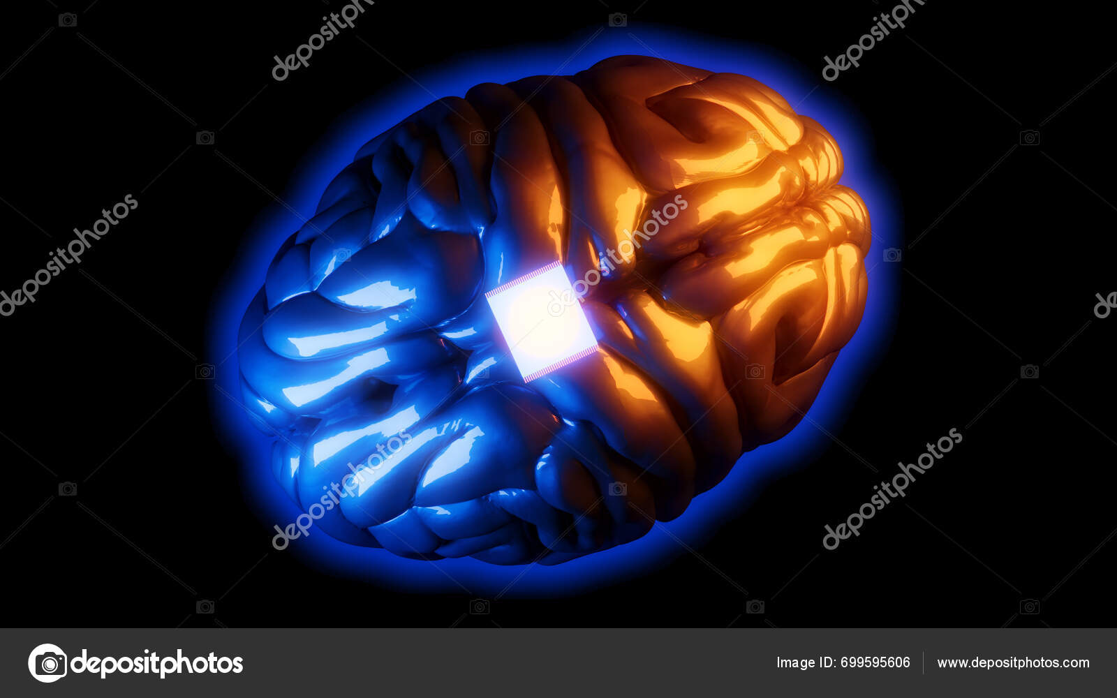 Link Neuralink New Artificial Intelligence Technology Allows You ...