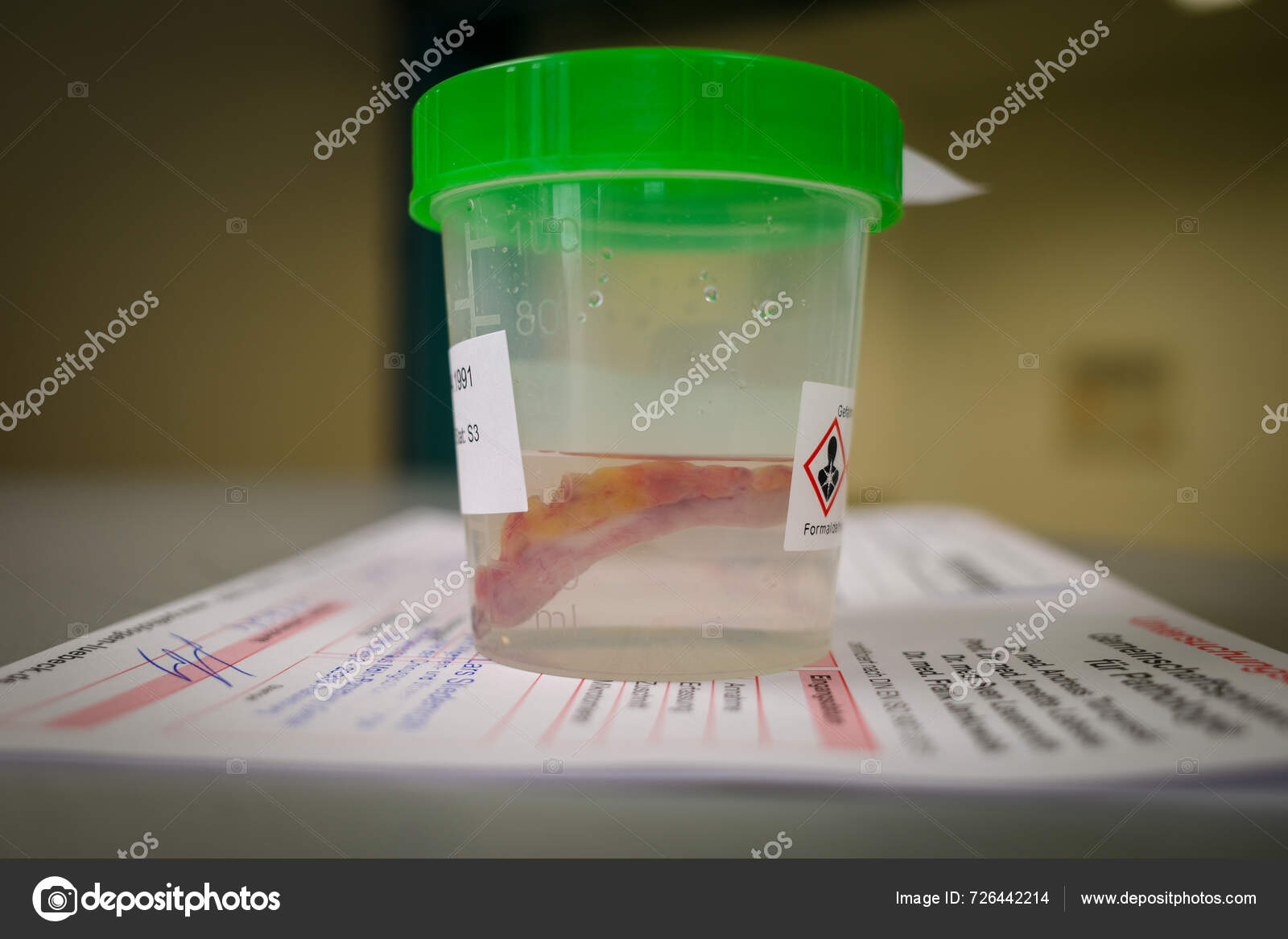 Coloca Apéndice Extraído Plato Disección Lleno Formalina — Foto de ...