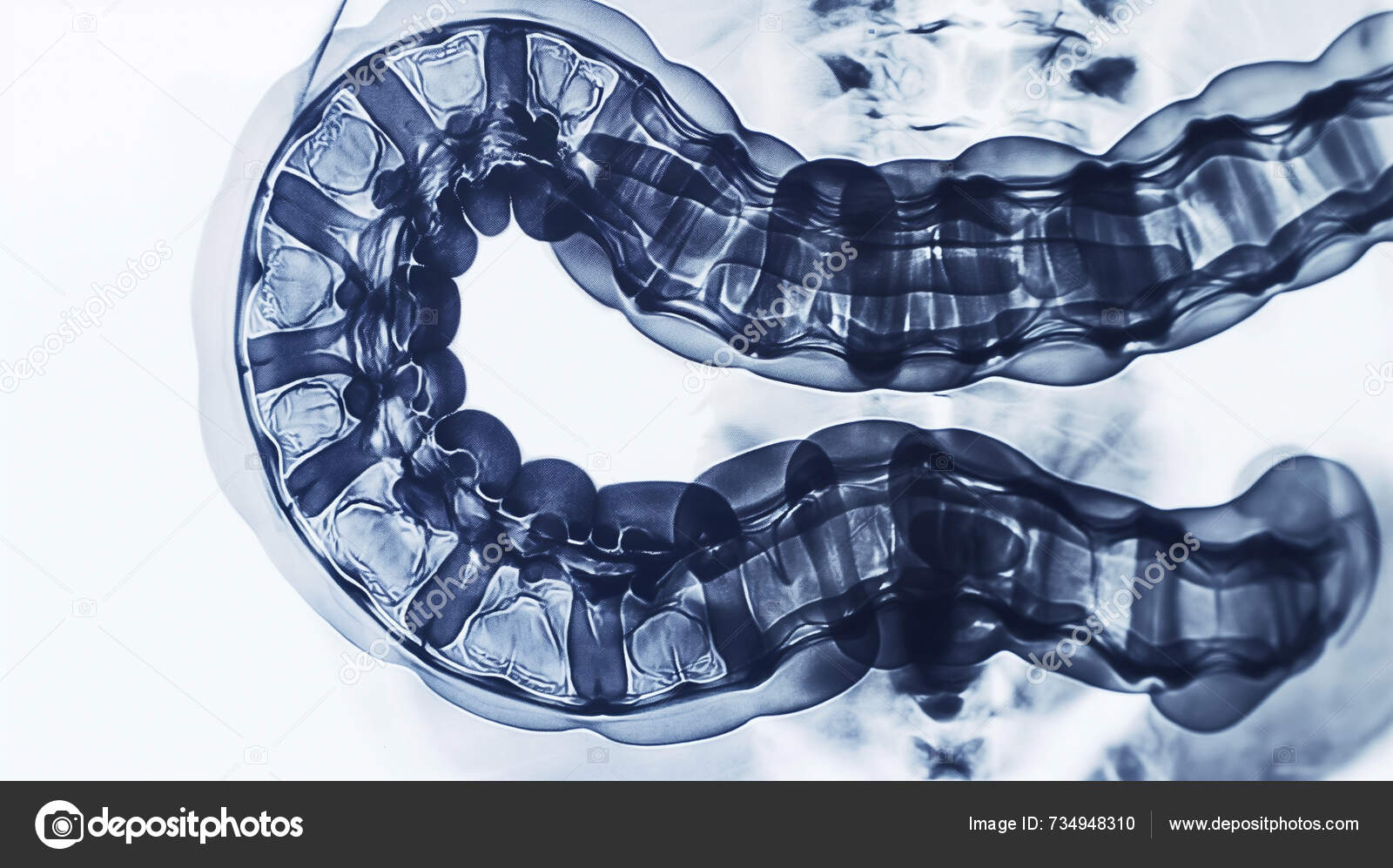 Detailed Ray Section Human Colon Showing Its Intricate Structure ...