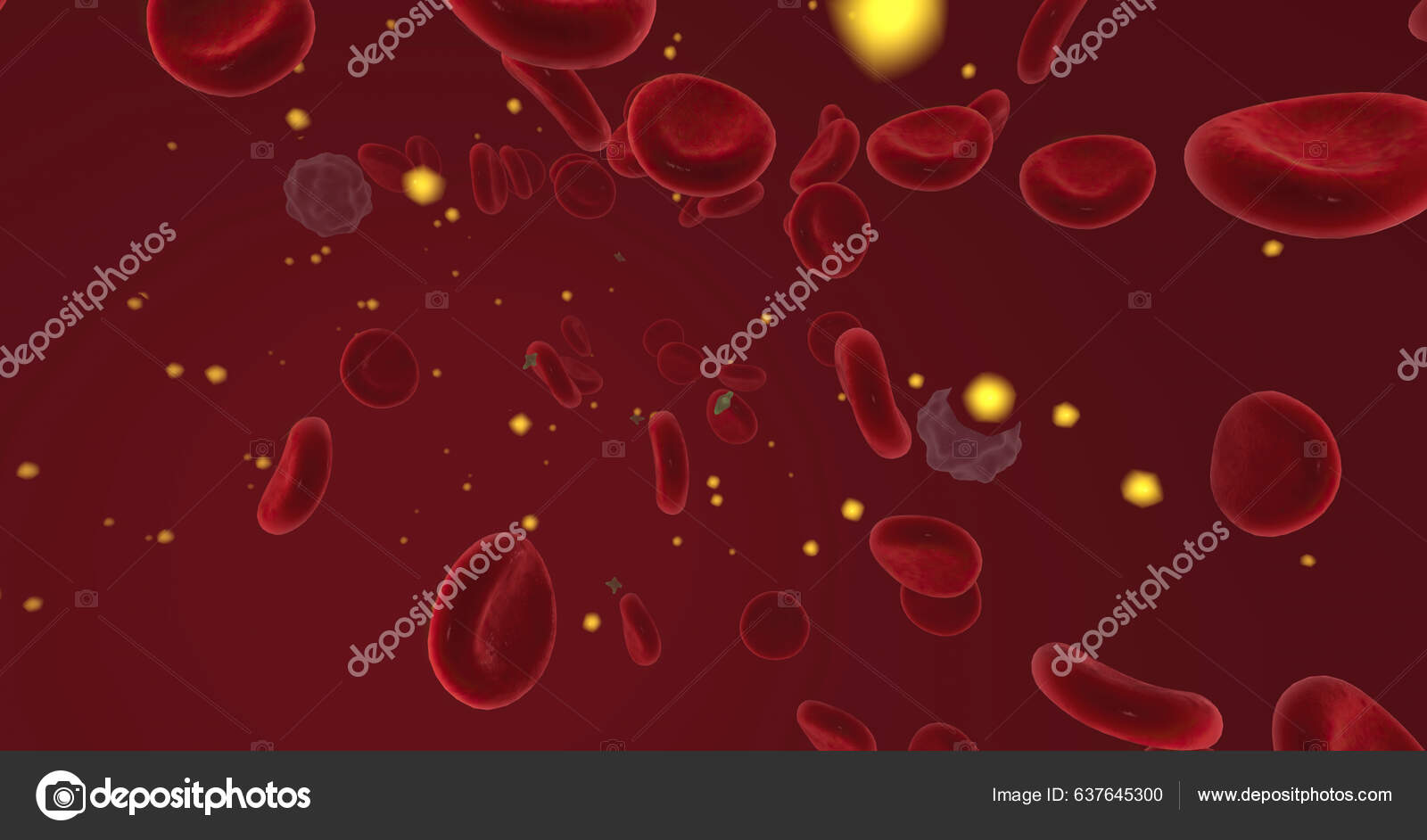 Hypercalcemia Condition Characterized Increased Calcium Levels Blood ...