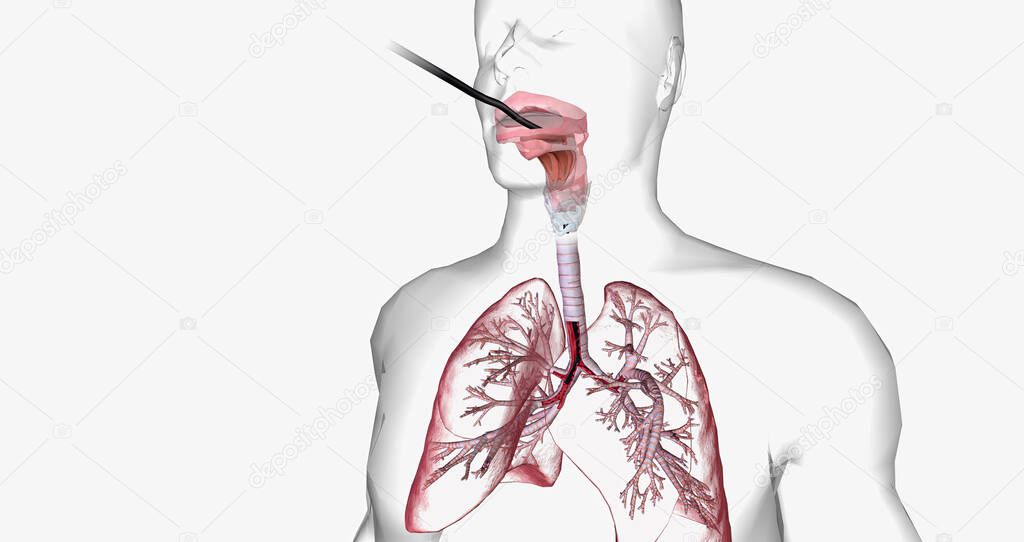 La broncoscopia es un procedimiento invasivo que se usa para observar ...