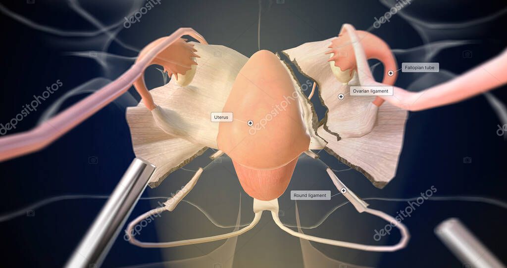 Clipping and Ligating of Fallopian Tubes and Ovarian Ligaments 3D ...