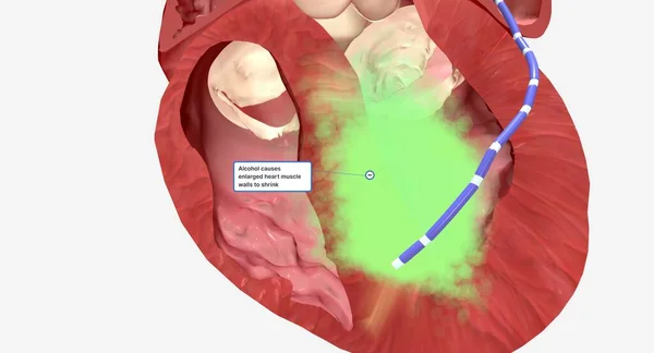 100,000 Anatomia aórtica Vector Images | Depositphotos