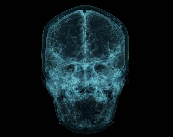 Face mri Stock Photos, Royalty Free Face mri Images | Depositphotos