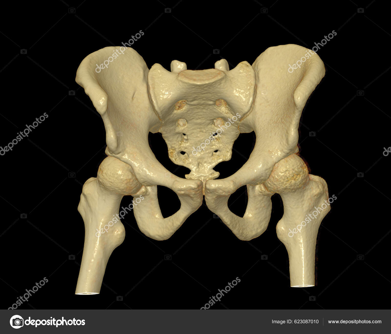 Mostrando Los Huesos De La Cadera