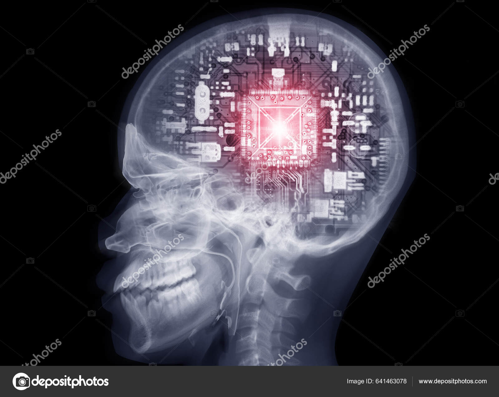 Cpu Skull Artificial Intelligence Concept Rendering — Stock Photo ...