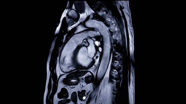 Myelogram mri images libres de droit, photos de Myelogram mri ...