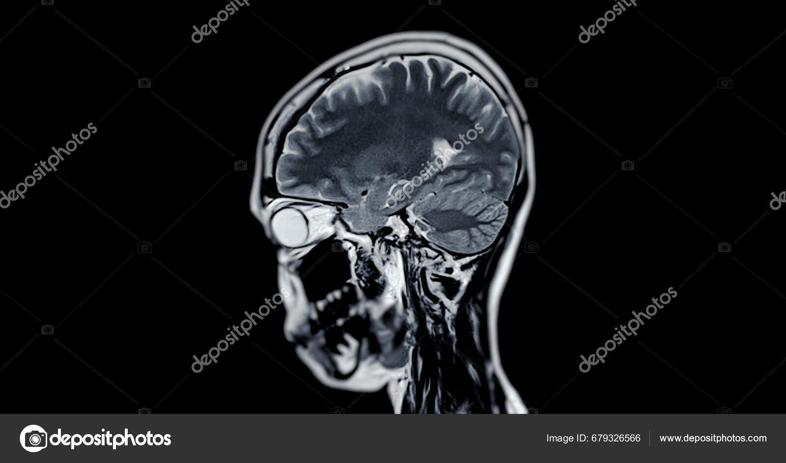 Mri Scan Brain Detect Brain Diseases Sush Stroke Disease Brain — Stock ...