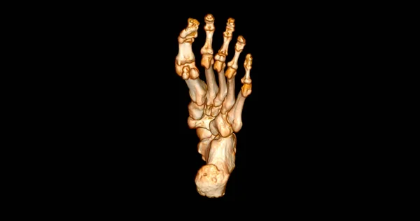 Tomografias Stock Photos, Royalty Free Tomografias Images | Depositphotos