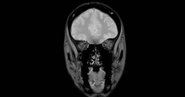 Face mri Stock Photos, Royalty Free Face mri Images | Depositphotos