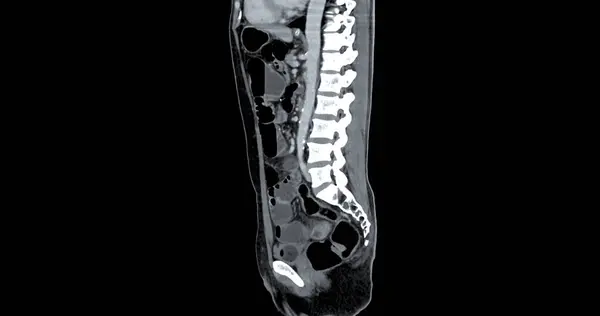 Tomography trachea Stock Photos, Royalty Free Tomography trachea Images ...