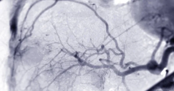 Medios de contraste intravenoso images libres de droit, photos de ...