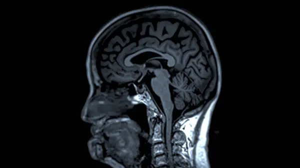 Mri back scan Stock Photos, Royalty Free Mri back scan Images ...