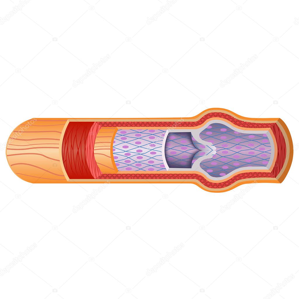 Arteria y estructura de válvula. Viena en sección transversal ...