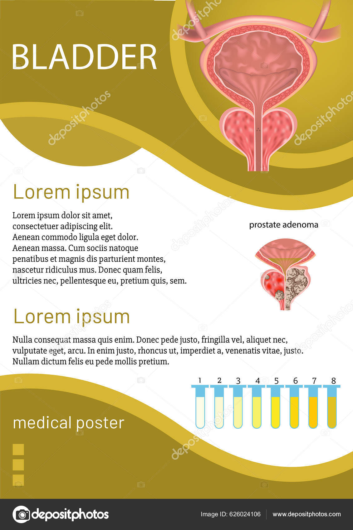 Medical Template Printing Bladder Prostate Infographics Vector ...
