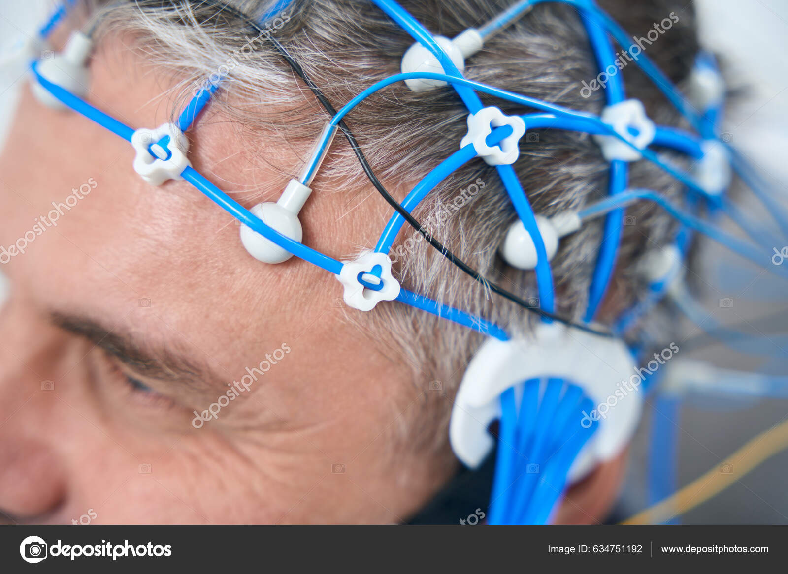 Middle Aged Man Diagnosis Eeg Electroencephalography Cap Sensors His ...