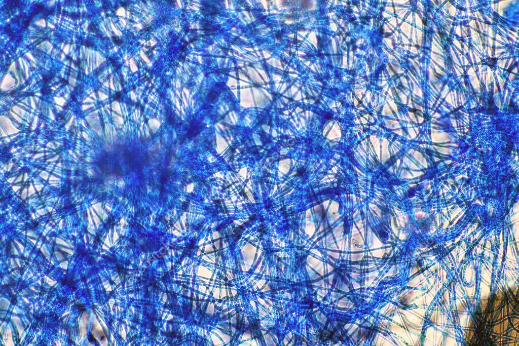 Microscopio de cepa de esporas de hongos negros con algodón Lactofenol ...