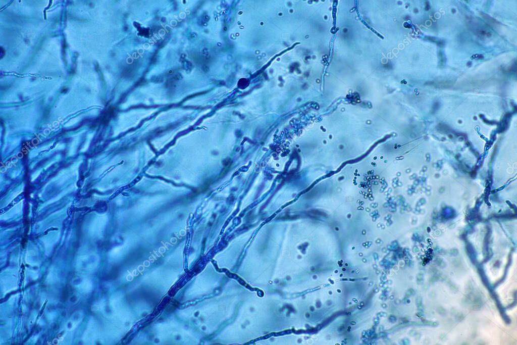 Microscopio de cepa de esporas de hongos negros con algodón Lactofenol ...