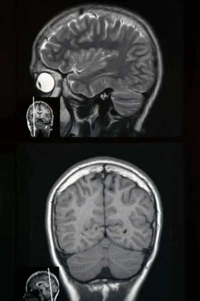 Macrophoto of computer tomography with the brain. Medical, scientific and educational MRI of the ...