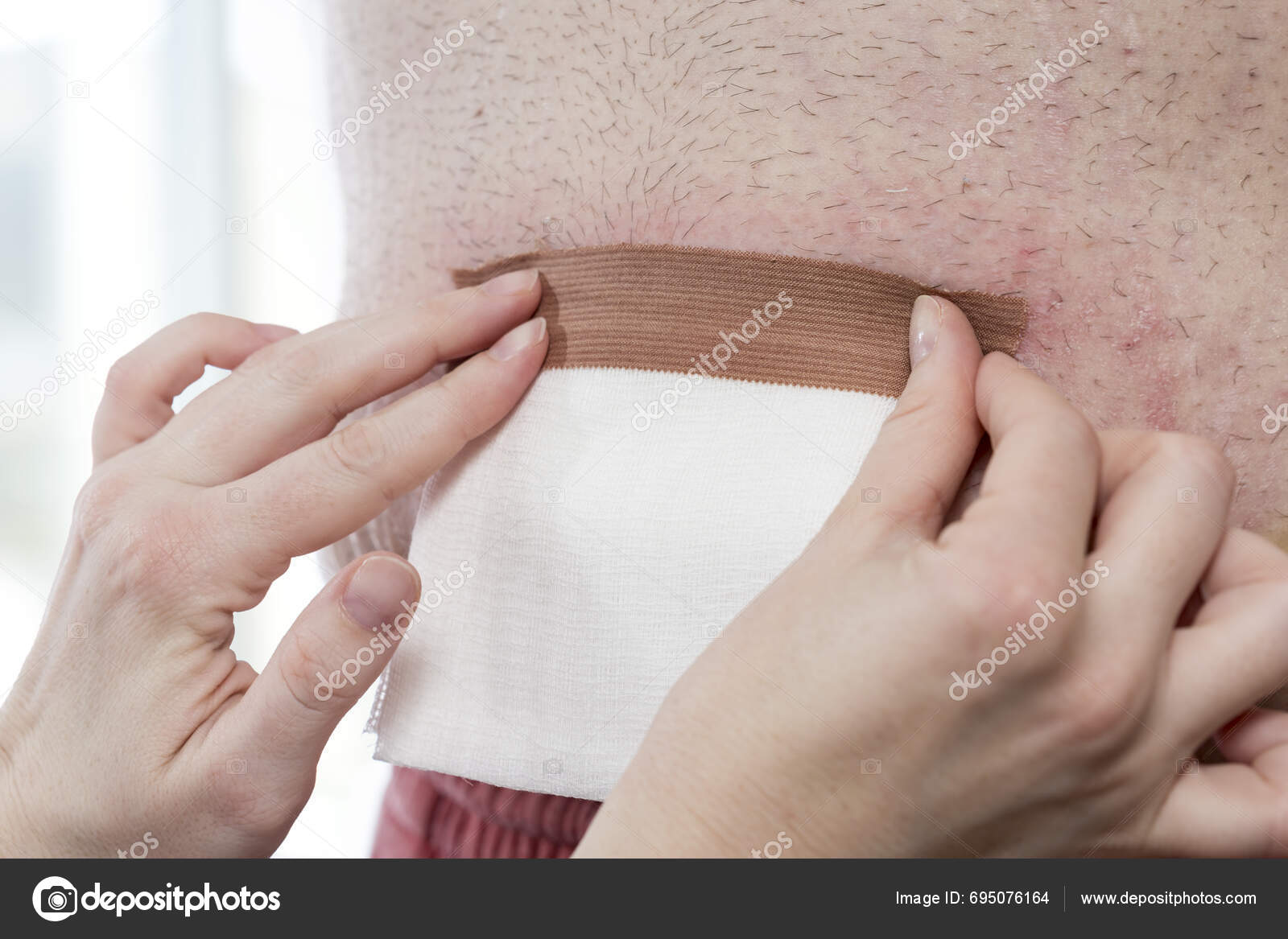 Detail Nurse's Hands Dressing Patient's Umbilical Hernia Wound Placing ...