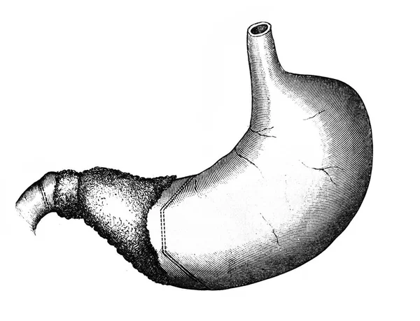 Duodeno imágenes de stock de arte vectorial | Depositphotos