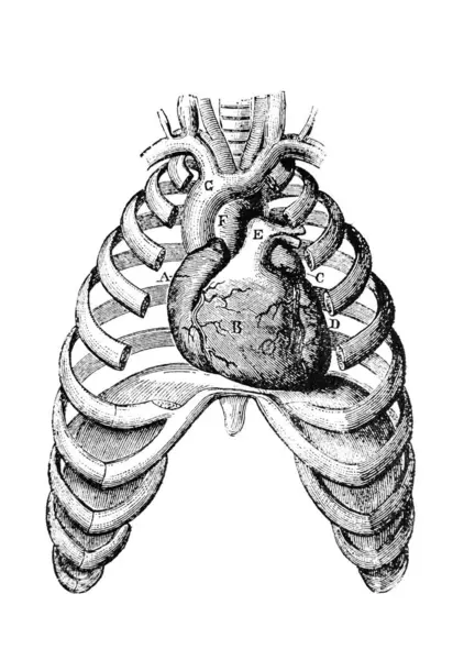 Heart attack anatomy Stock Photos, Royalty Free Heart attack anatomy ...