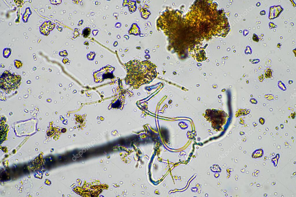 microorganismos del suelo, con hifas de hongos del suelo creciendo en ...