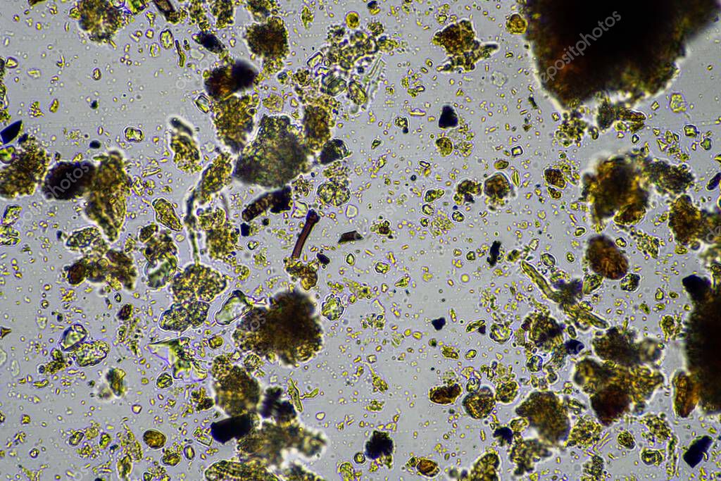 soil microorganisms in a soil sample, soil fungus and bacteria on a ...