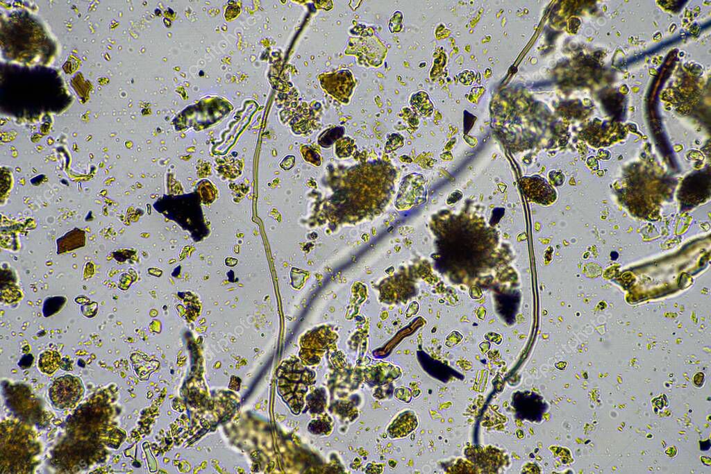 soil microorganisms in a soil sample, soil fungus and bacteria on a ...