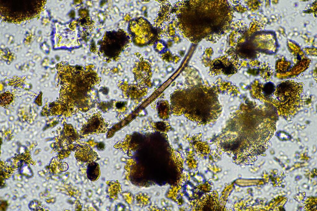 soil microorganisms in a soil sample, soil fungus and bacteria on a ...