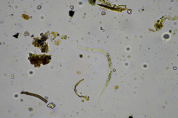Parasitas Intestinais Em Humanos Parasitoses Intestinais – Miudinhos