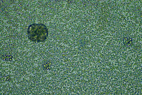 Cyanobacteria microscope Stock Photos, Royalty Free Cyanobacteria ...